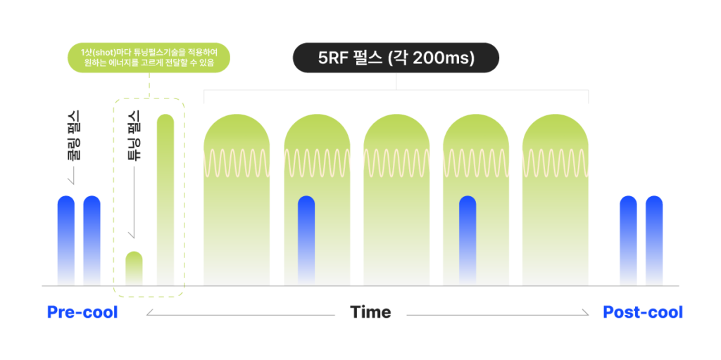 써마지 FLX | 1mm성형외과